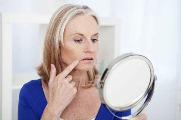 How to Get Rid of Marionette Lines: Expert Advice from Cityskin - Cityskin